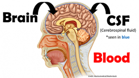 Increased Intracranial Pressure (ICP) NCLEX Review