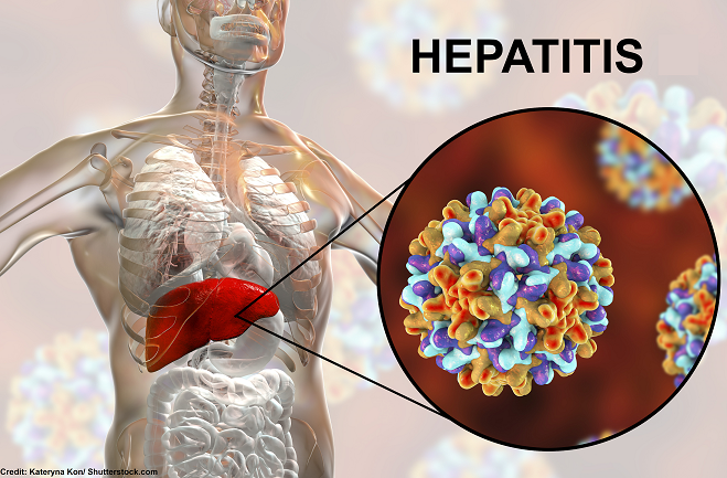 Hepatitis A, B, C, D, E Nursing NCLEX Review